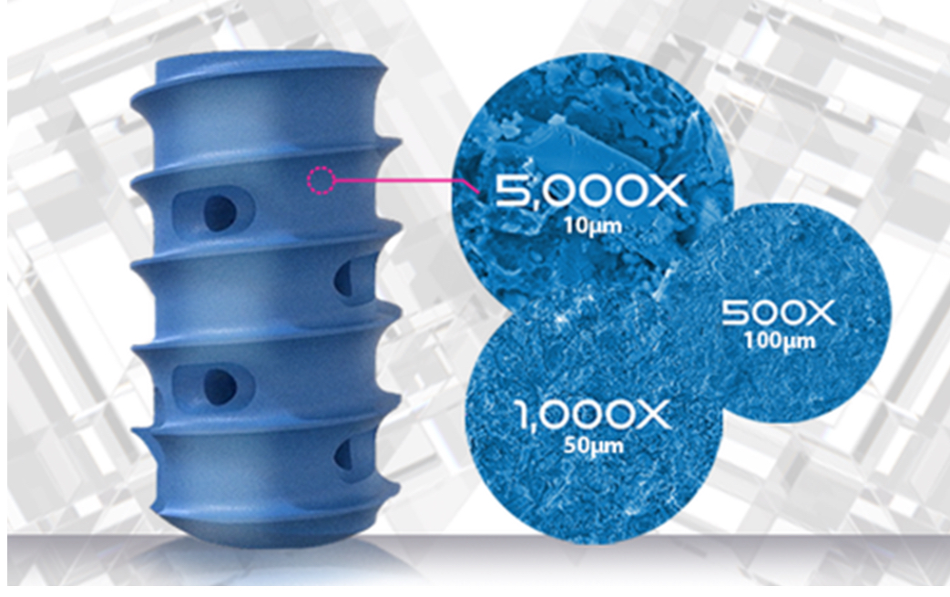 ION Minimally Invasive Facet Fusion: 5 Revolutionary Benefits