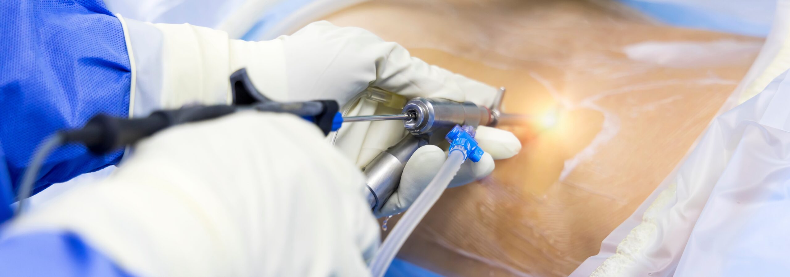 Interventional Spine Surgery: 5 Powerful Advances to Know