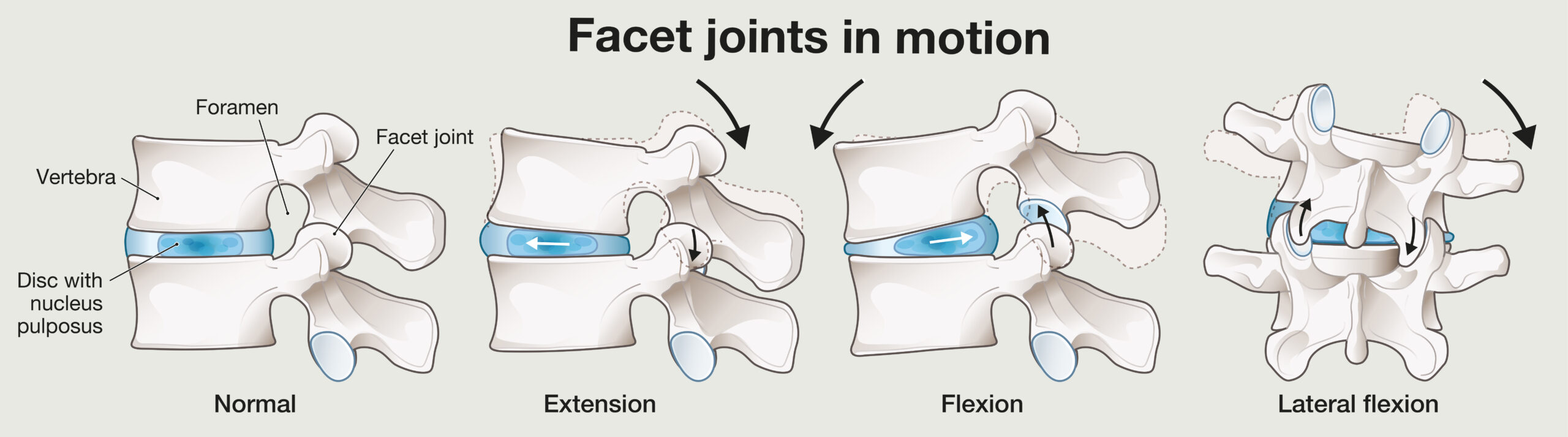 Facet Joint Syndrome: 7 Expert Options for Lasting Relief