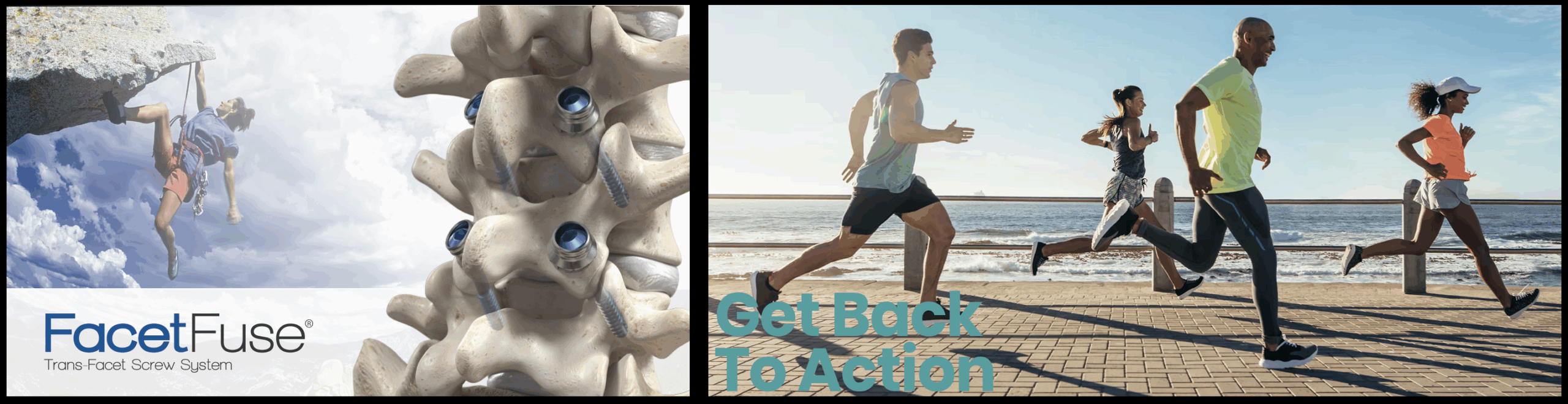 FacetFuse: 7 Reasons to Choose This Breakthrough Fusion
