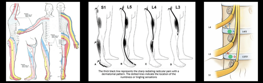 L5 Pain: 5 Important Insights for Relief